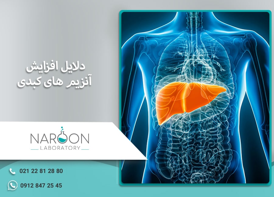 دلایل افزایش آنزیم‌های کبدی چیست؟